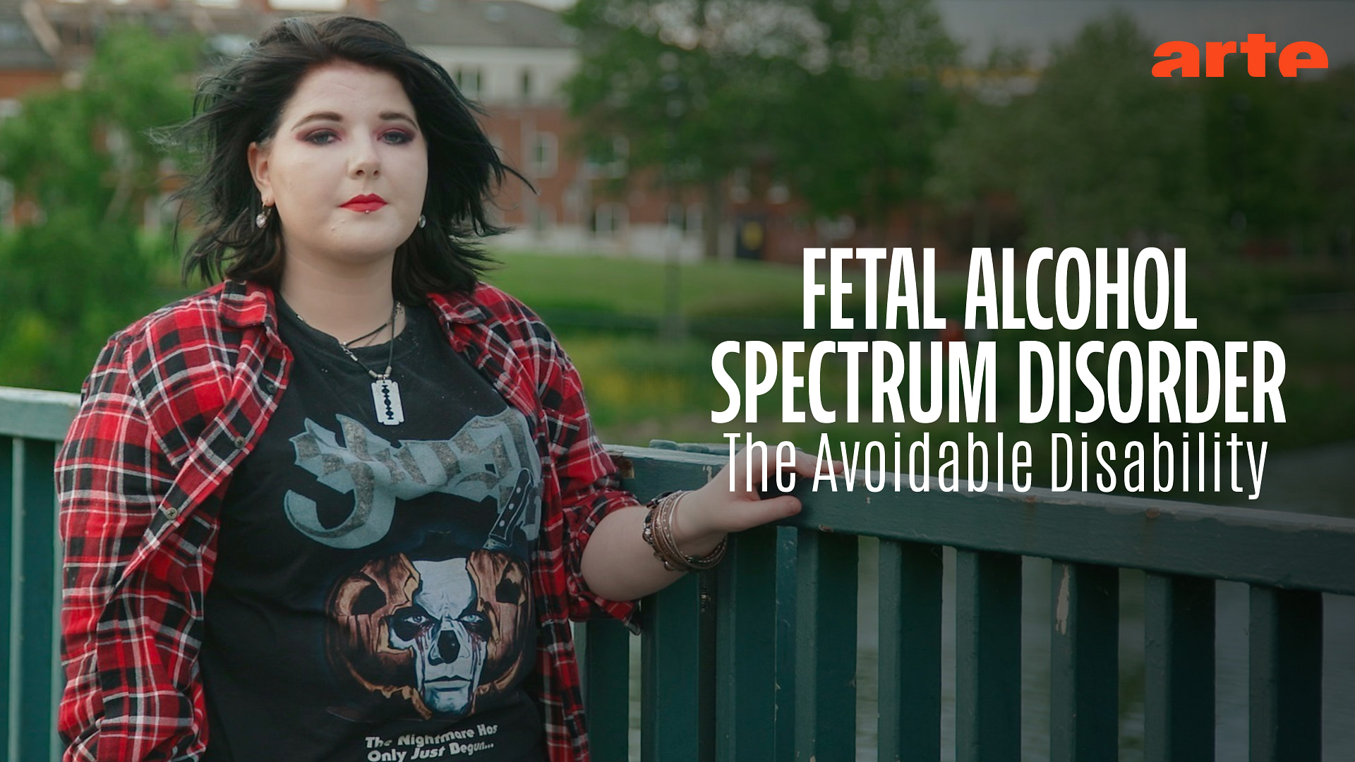 Fetal Alcohol Spectrum Disorder - Re: Drunk in the Womb - Watch the ...